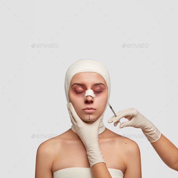 Isolated vertical shot female with bruises and lifting marks, gets ...