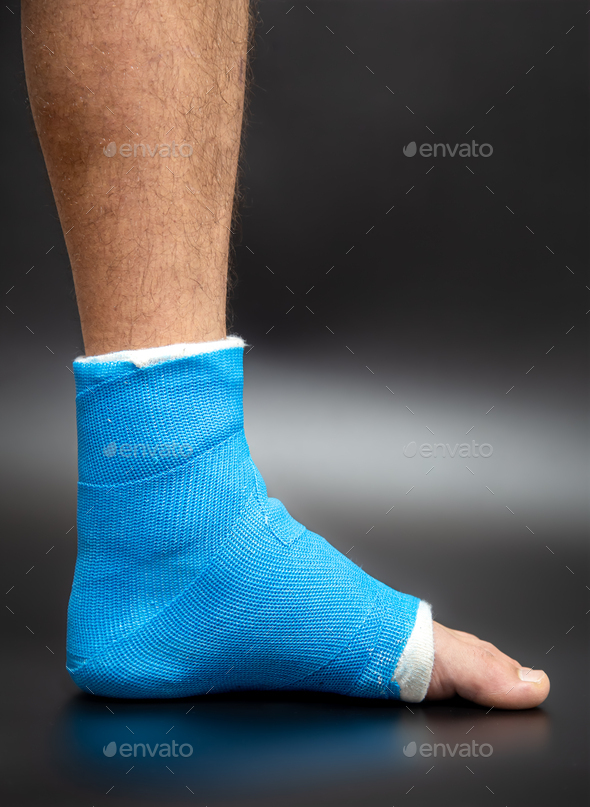 Close up photos of foot blue splint for treatment of injuries from ...