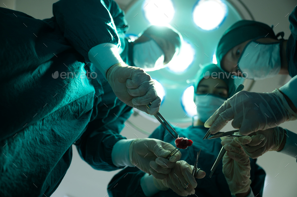 Medical team of surgeons in hospital doing invasive surgical ...