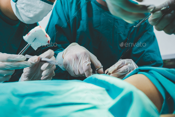 Medical team of surgeons in hospital doing invasive surgical ...