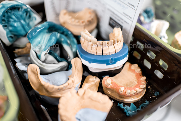 Dental models at the laboratory Stock Photo by RossHelen | PhotoDune