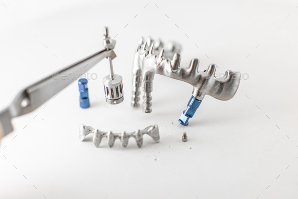 Metal frame for dental implants Stock Photo by RossHelen | PhotoDune