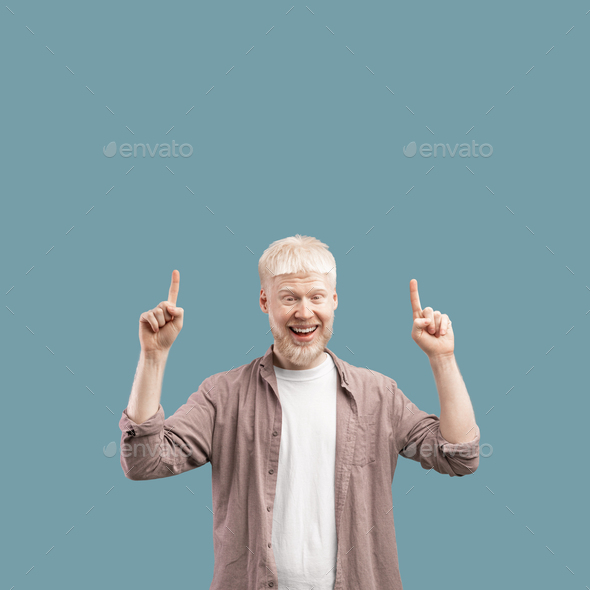 Special offer. Joyful young albino guy pointing fingers up on copy ...