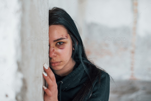 Portrait of beaten young woman with bruise under eye that standing and ...