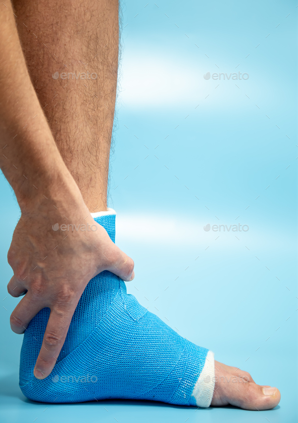 Close up photos of foot blue splint for treatment of injuries from ...