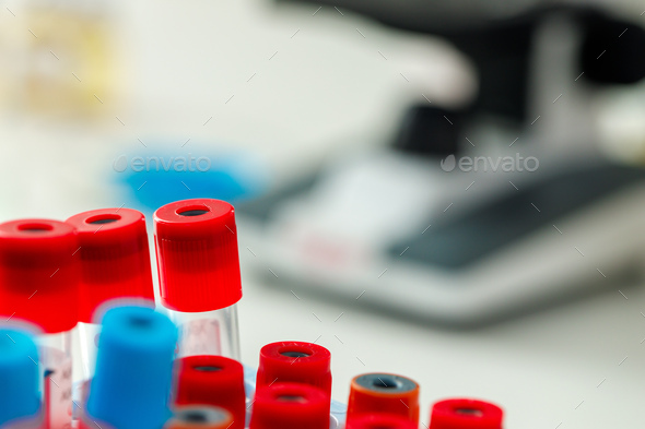Test tubes tops in a tray close up Stock Photo by FabrikaPhoto | PhotoDune