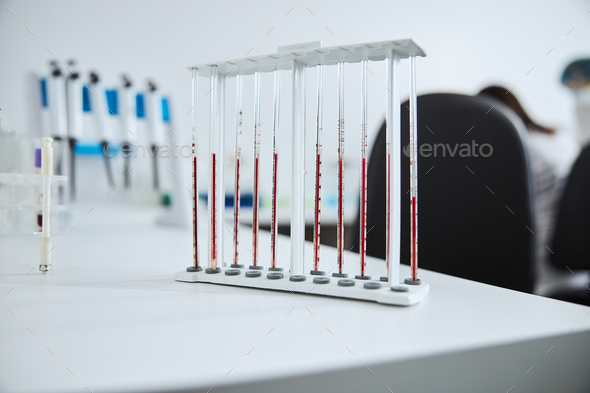 Graduated glass droppers with printed measurement marks Stock Photo by ...
