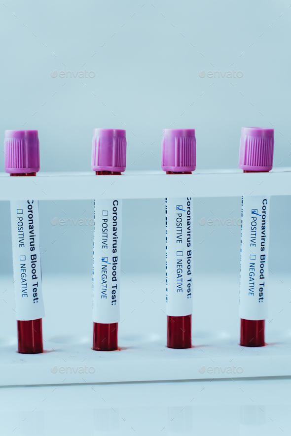 Blood test tubes in a row for laboratory blood analysis Stock Photo by ...