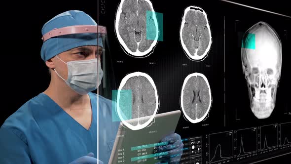 Mri Brain Data Monitor 2, Stock Footage | VideoHive