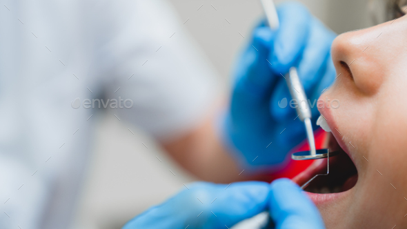 Operating teeth tooth, filling mouth cavity against caries decay dentist in dental clinic. Stock ...