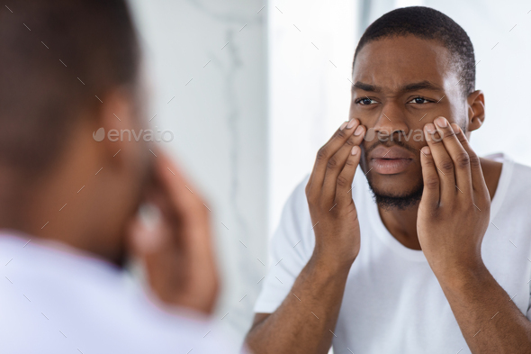 Dull Skin. Worried Young Black Man Looking At Mirror And Touching Face ...