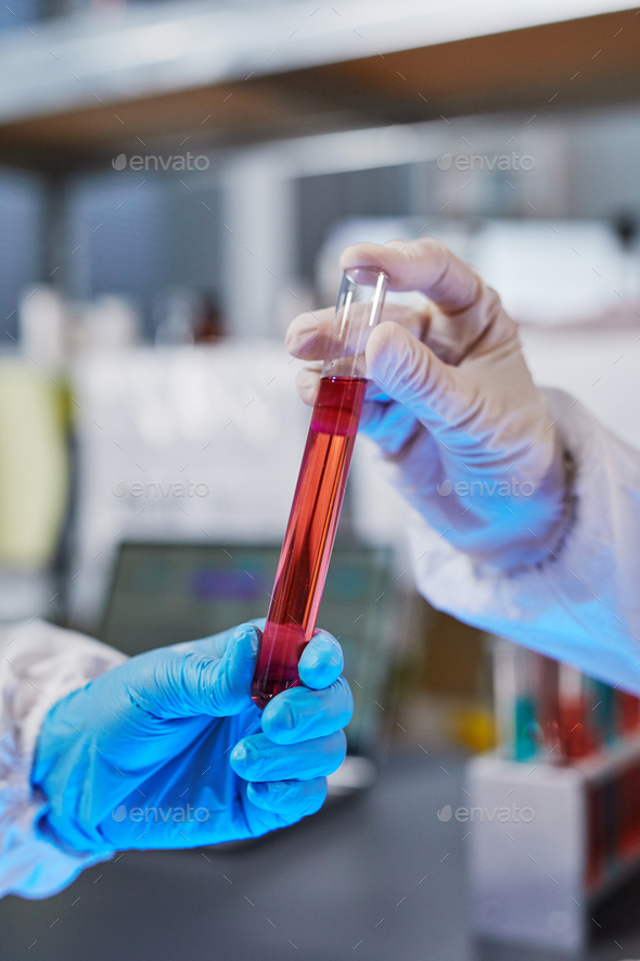 Medical sample in test tube Stock Photo by seventyfourimages | PhotoDune