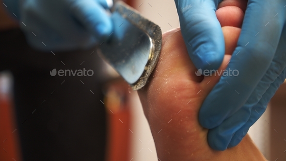 Removal of old skin on the female foot. Woman having spa procedure in ...