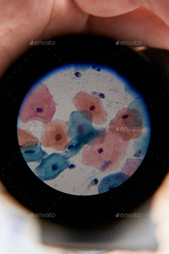 Color image in microscope of microorganisms in the lab Stock Photo by ...