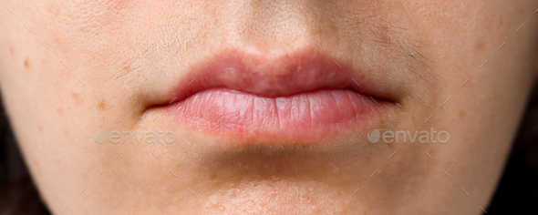 Close-up of a woman's mustache on her face. Illness, improper ...