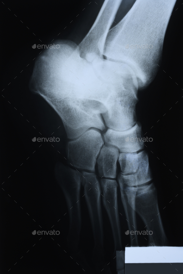 Anble X-ray detail Stock Photo by Simmi83 | PhotoDune