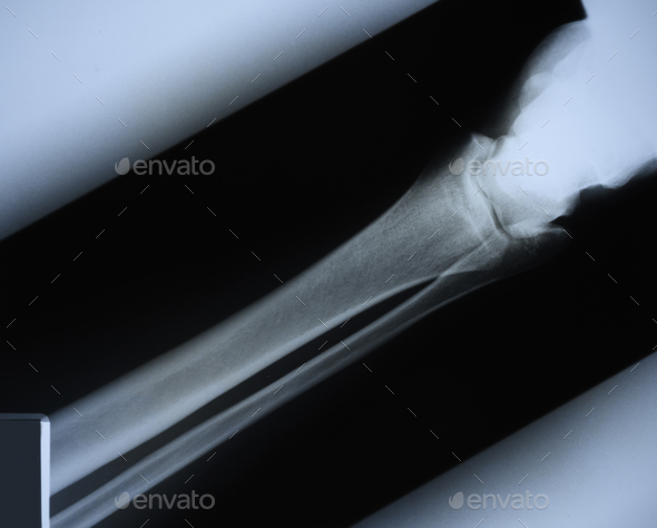 Details of X Ray Frame from Hospital Stock Photo by Simmi83 | PhotoDune