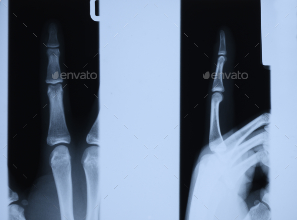 Details of X Ray Frame from Hospital Stock Photo by Simmi83 | PhotoDune