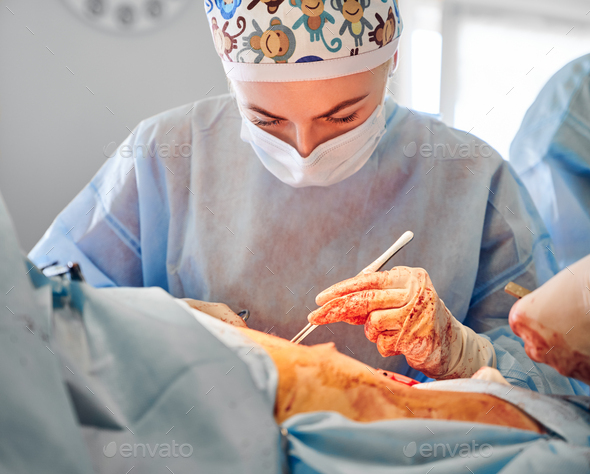 Female doctor doing abdominoplasty surgery in operating room. Stock ...