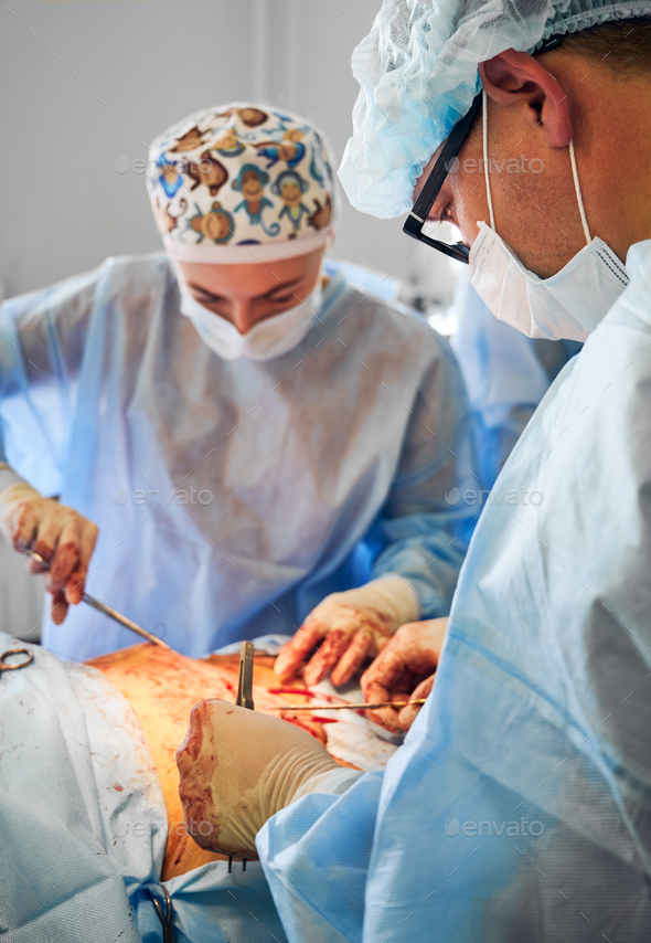 Surgical team doing tummy tuck surgery in operating room. Stock Photo ...