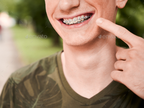 Cropped portrait of a young man, smiling and demonstrating his teeth ...