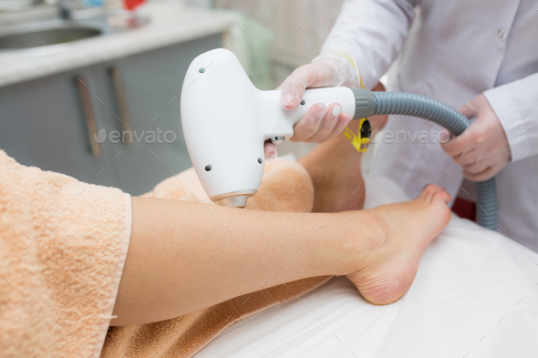 close up view of woman's leg getting laser treatment on her legs Stock ...