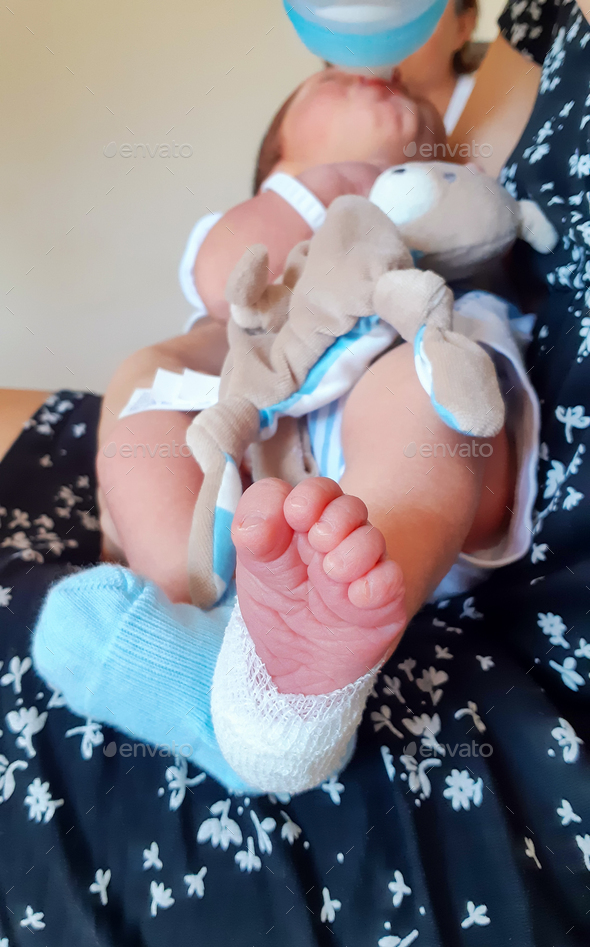 Detail of the foot of a medicated newborn after a blood draw from the ...