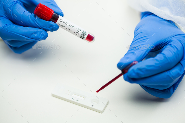 UK lab tech scientist placing blood sample on Rapid Diagnostic Test RDT ...