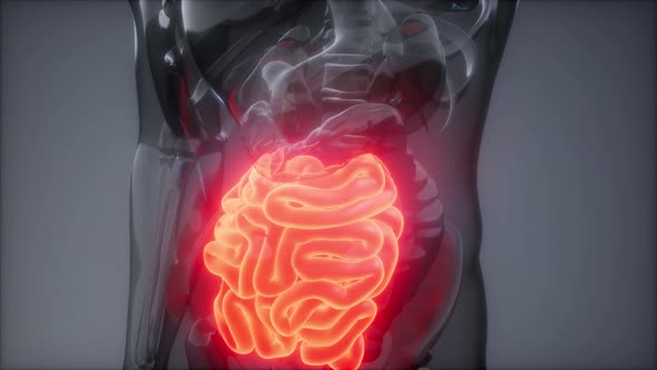 Human Small Intestine Radiology Exam, Motion Graphics | VideoHive