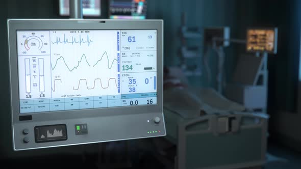 ECG Alerts Of Patient Dying From Rapid Decrease Of Heart Rate And ...