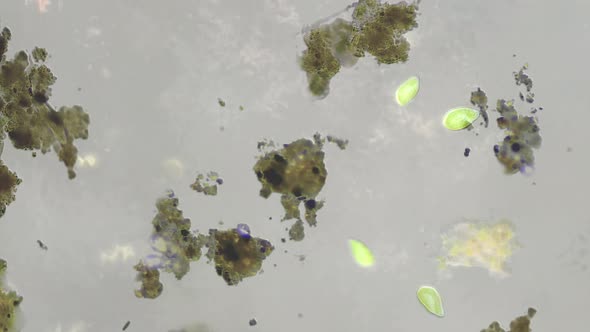 Analysing Infusoria Slippers Under Microscope At Modern Scientific ...