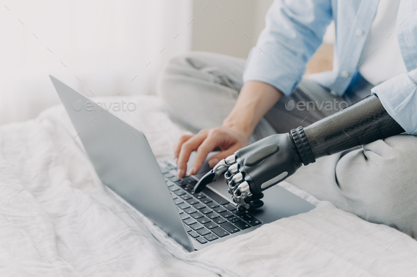 Bionic prosthesis and healthy arm. Hands of disabled girl are typing on ...