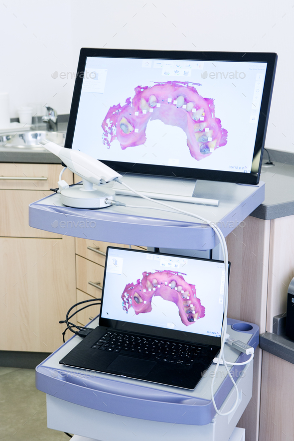 3D teeth scans on computer and laptop in dentist office Stock Photo by ...