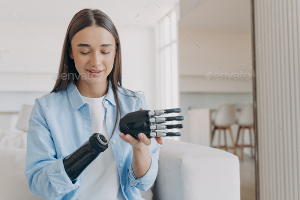 Disabled young woman is assembling bionic arm with hand. Prosthesis is ...