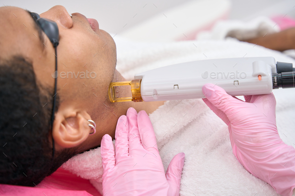 Beauty clinic client undergoing laser epilation procedure on skin Stock ...