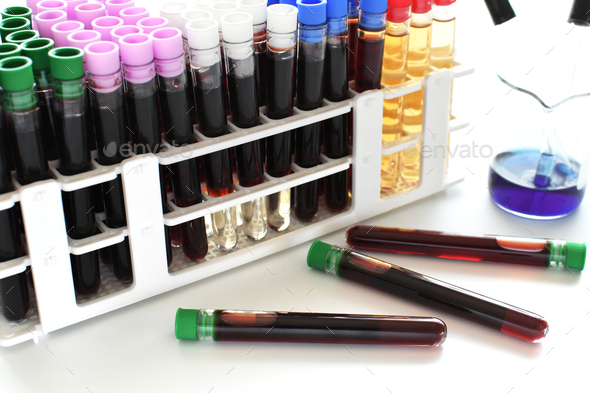 Vials of blood in lab laboratory for testing, test tubes in background ...