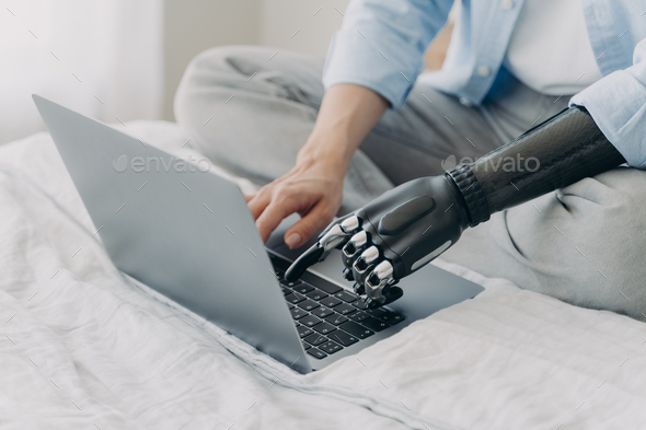 Close up of disabled woman working on laptop, typing on keyboard, using ...