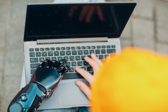 Young disabled man with artificial prosthetic hand using typing on ...