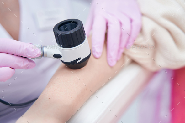 Professional dermatologist using dermoscope on patient skin Stock Photo ...