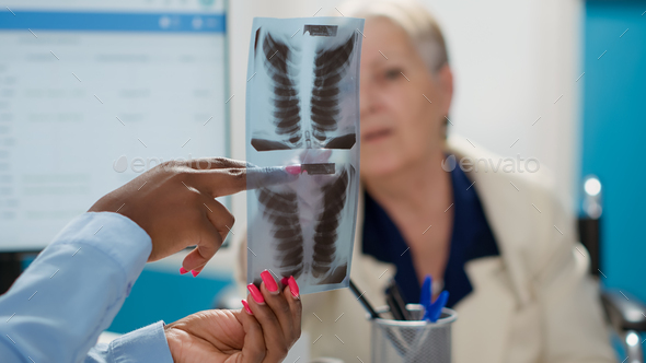 Health specialist explaining x ray scan results to elderly patient ...