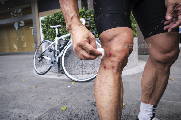 Close-up of cyclist cleaning his wounds on leg after falling from bike ...