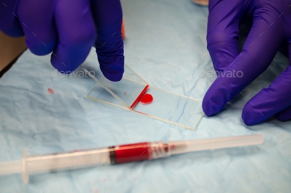 Making blood smear over a glass slide Stock Photo by manjurulhaque
