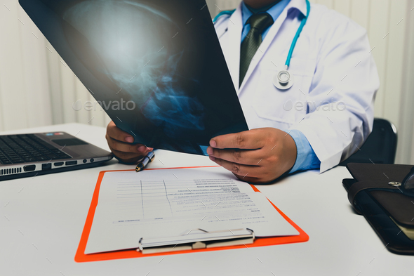 Doctor diagnose and analyze on x-ray film of patient. Stock Photo by ...