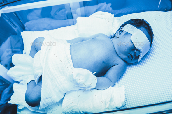 Newborn baby with jaundice kept under ultraviolet lamp in an incubator ...