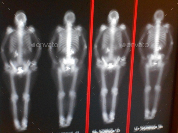 Radioactive Scans Stock Photo by AZ-BLT | PhotoDune