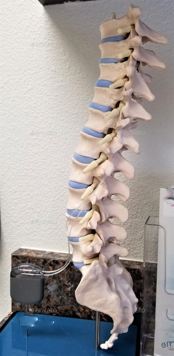Human Spine Display! Stock Photo by AZ-BLT | PhotoDune