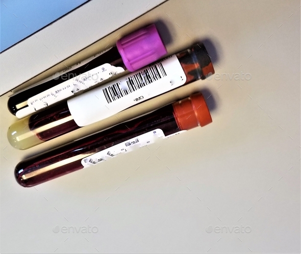 Healthcare and Medicine! Vials of blood from a patient! Stock Photo by ...