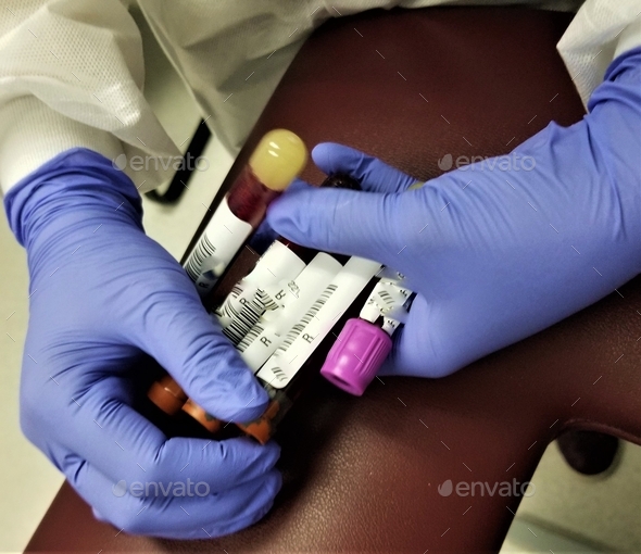 Phlebotomy! Vials of Human Blood! Stock Photo by AZ-BLT | PhotoDune