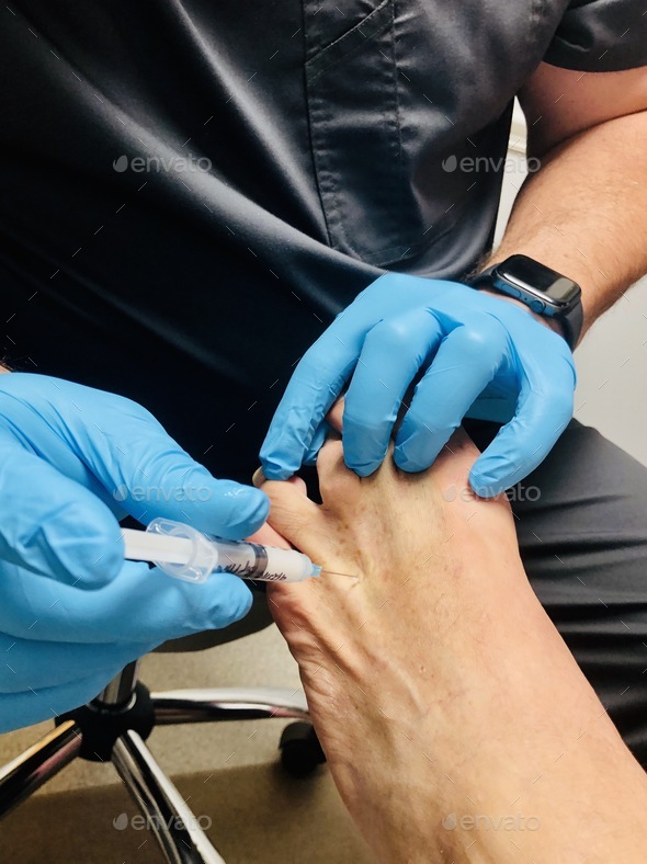 At the doctors, patient getting a shot in his foot. Stock Photo by marisap7
