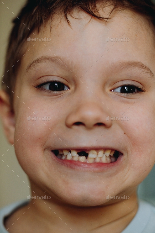 Cute little boy smiling demonstrating lost baby tooth Stock Photo by ...